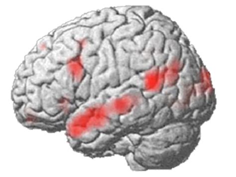 Cortex And Pyramidal Systems Flashcards Quizlet