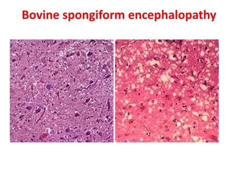 Pathology Transparency Slides Histo Pathologypptx Pathology Transparency Slides Histo Pathologypptx