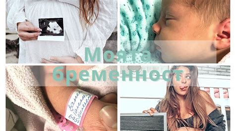 МОЯТА БРЕМЕННОСТ И РАЖДАНЕ СИМПТОМИ 41 ВА СЕДМИЦА ДВЕ ИНДУКЦИИ ВЪЗСТАНОВЯВАНЕ Youtube