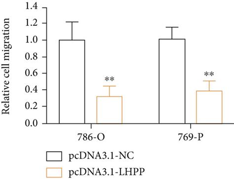 Transwell Migration Assay Was Performed To Investigate Cell Migration Download Scientific