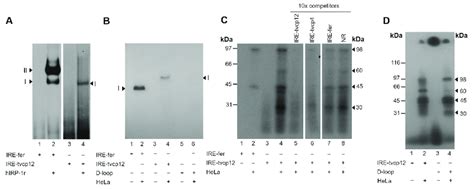 The Interaction Between The IRE Tvcp12 MRNA Structure And Human IRPs Download Scientific