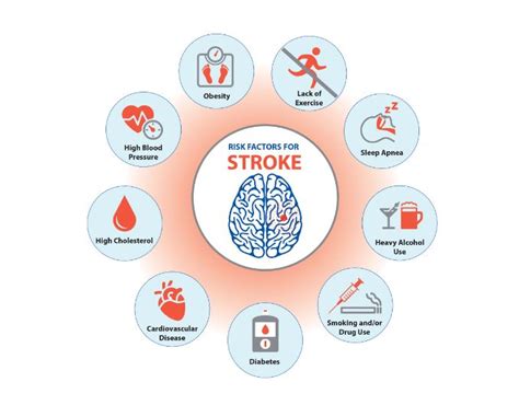 Understanding Genetics Of Stroke