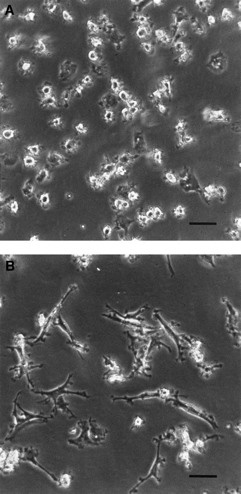 morphological characteristics of human dcs derived from peripheral