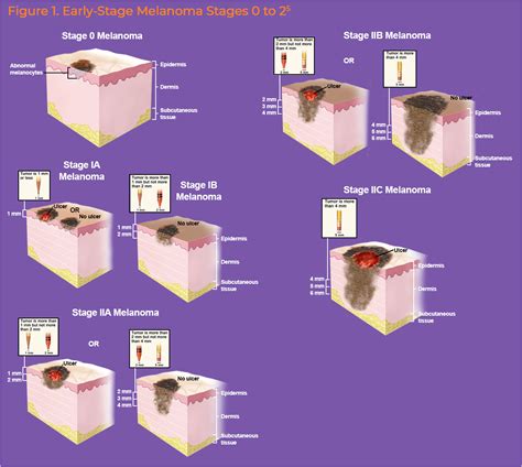 Treatment Of Melanoma Activate Melanoma
