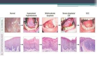 Upper Git And Salivary Gland PPT