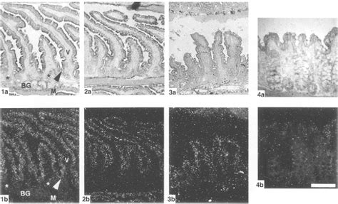 Sacculus Rotundus Semantic Scholar