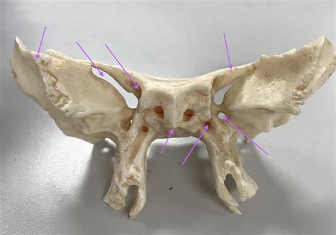Sphenoid Bone Diagram Quizlet