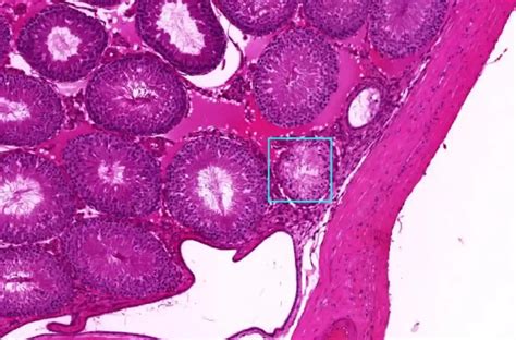 Ai Method Identifies Diseases Faster Than Humans