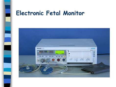 Ppt Fetal Monitoring Powerpoint Presentation Free Download Id 1115826