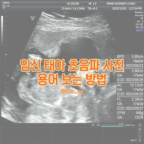 임신 태아 초음파 사진 용어 보는 방법 네이버 블로그