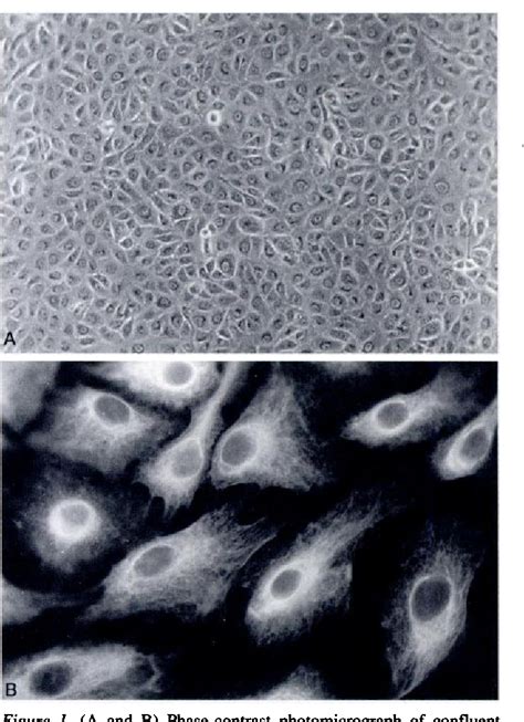 Table 1 From High Glucose Increases Prostaglandin E2 Synthesis In Human Peritoneal Mesothelial