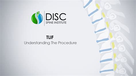 Minimally Invasive Tlif Procedure In Dallas Texas