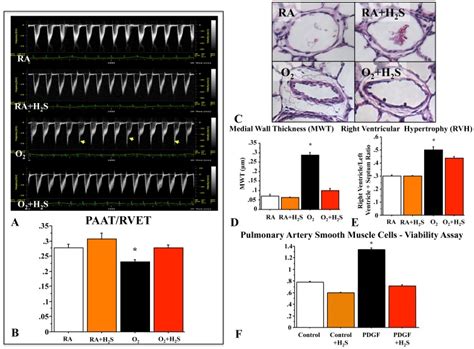 A Pulmonary Arterial Acceleration Timeright Ventricular Ejection