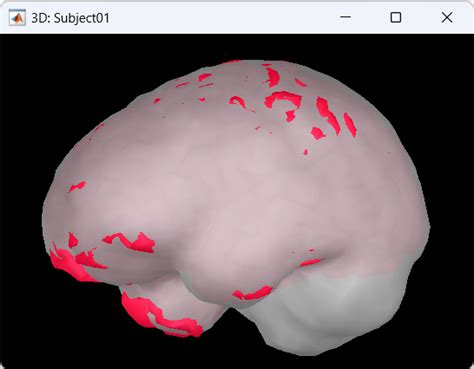 Bem Surfaces Computation Can Be Improved · Issue 607 · Brainstorm Toolsbrainstorm3 · Github
