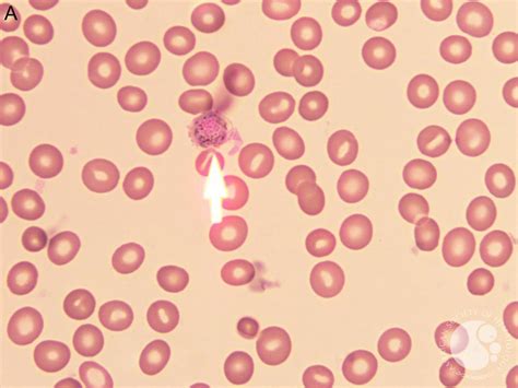 Plasmodium Vivax Gametocyte 1