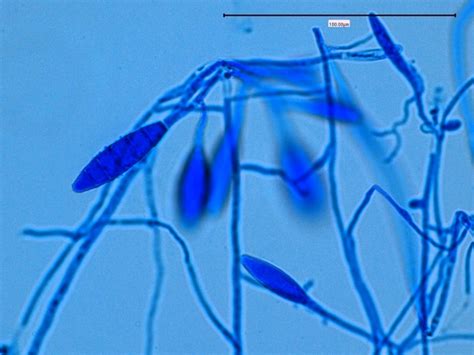 Fun With Microbiology Whats Buggin You Microsporum Gypseum