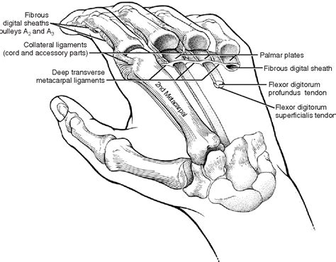 Index Finger Mcp Joint Pain At Regina Bruce Blog