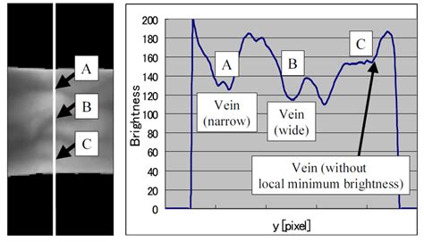 Cross Sectional Profiles Of Veins 10 Download Scientific Diagram