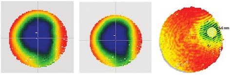 A Profile Of The Wavefront Before Triggering With Intense Laser Download Scientific Diagram