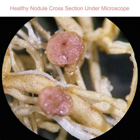 How Why Where When And What If You Have Problems Of Nodulation