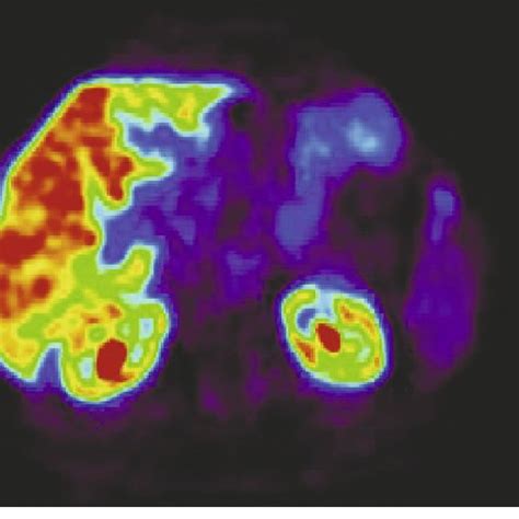 Elekta Response Gating Control Interface A Gating Switch Box B Download Scientific