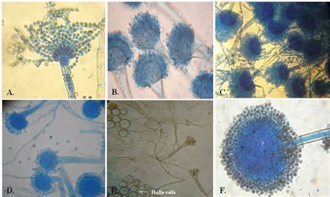 Microscopic Characters Of Aspergillus Isolates A A Flavus B A Download Scientific