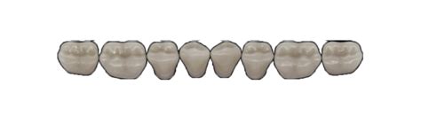 Bronze 2 Leonardodental