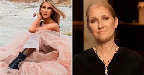 Choroba Ju Mení Na Sochu Speváčke Celine Dion Diagnostikovali Lekári