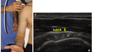 The Use Of Ultrasound Images In Manual Therapy And Additionally In