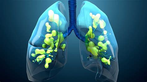 The Science Of Mold Respiratory Tract Invasion And Effects