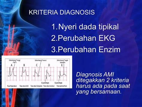 Laporan Kasus Acs Stemi Ppt