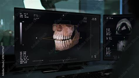 Vidéo Stock Medical System Interface Deals With The Analysis Of Tooth X