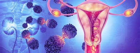 여성암 중앙한방병원