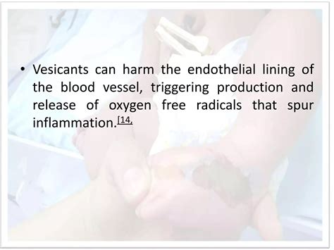 Extravasation In Neonate Pptx