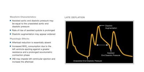 Incorrect Iabp Timing Pre