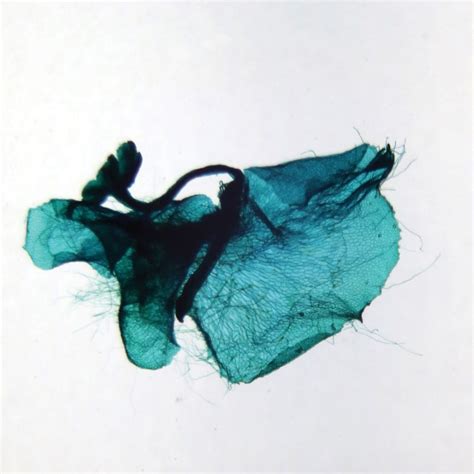 Fern Sporophyte Microscope