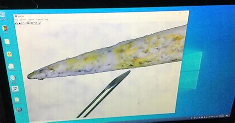 Thumbtack Vs Lancet Album On Imgur