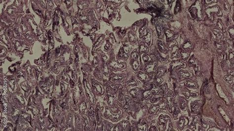 human scrotum cells under a microscope zoom in animation Stock ビデオ Adobe Stock