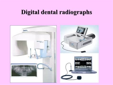 Pattern Recognition Forensic Dental Identification Ppt