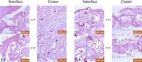 Histological Observation Of The Healing Of The Bone Defect Area Filled