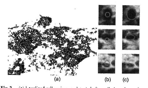 Figure 2 From Automatic Cell Segmentation Using A Shape Classification Model In