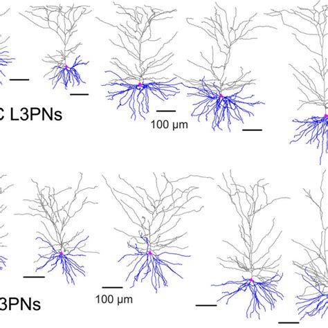 Quantitative Analysis Of Dendritic Spine Density In Basal Dendrites Of
