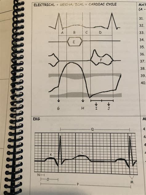 Echo An ECG Midterm Diagram Quizlet