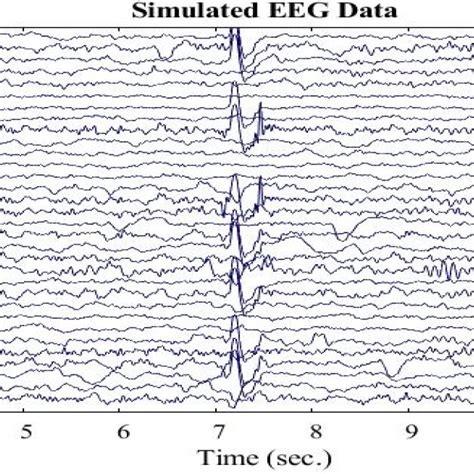 ICs Of The Simulated Multichannel EEG Data Components And Download Scientific