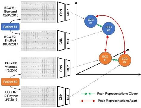 Biometric Contrastive Learning For Data Efficient Deep Learning From Electrocardiographic Images