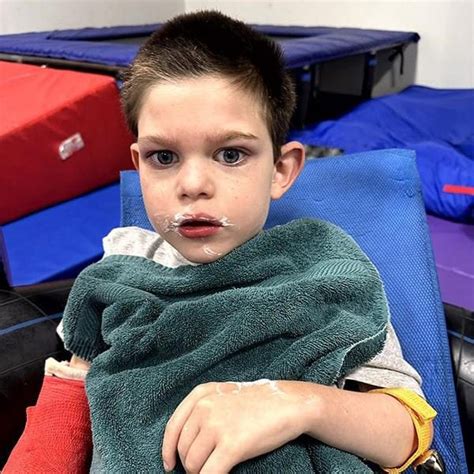 Constraint Induced Movement Therapy By Cheshire Fitness Zone