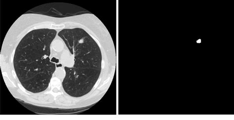 P D Project On Lung Ct Tumor Segmentation Training Rmachinelearning