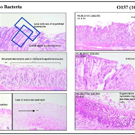 Representative Histopathological Reports From The Adherence Assay Download Scientific Diagram