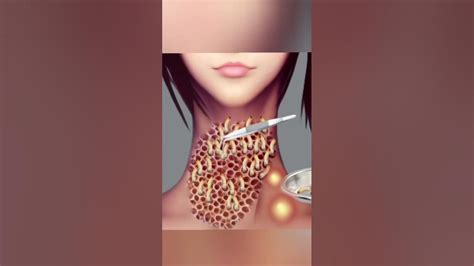 Asmr 여드름 피부 관리 애니메이션 Face Stone Removal Skin Care Spa Facial Makeup
