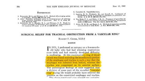 Vascular Rings And Slings Types Haemodynamics Presentation And